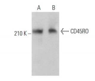 CD45RO Antibody (UCH-L1) - Western Blotting - Image 374146