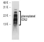 CD52 Antibody (HI186) | SCBT - Santa Cruz Biotechnology
