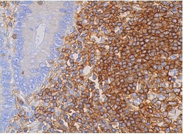 CD53 Antibody (B-12) | SCBT - Santa Cruz Biotechnology