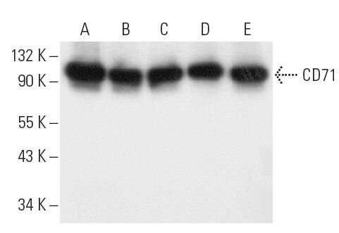 CD71/TFRC/Transferrin Receptor抗体 (3B8 2A1) | SCBT - Santa Cruz ...