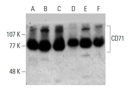 CD71/TFRC/Transferrin Receptor抗体 (H68.4) | SCBT - Santa Cruz Biotechnology