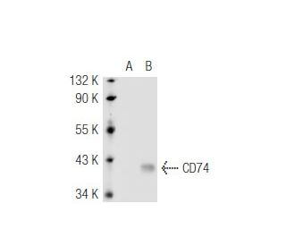 Anti-CD74 Antibody (In-1) | SCBT - Santa Cruz Biotechnology