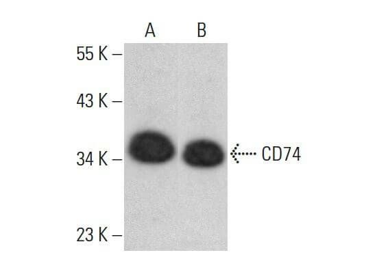 CD74 Antibody (PIN.1) | SCBT - Santa Cruz Biotechnology