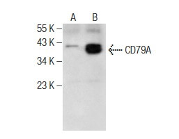 CD79A Antibody (HM47) | SCBT - Santa Cruz Biotechnology