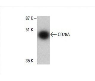 CD79A Antibody (HM57) - Western Blotting - Image 393096