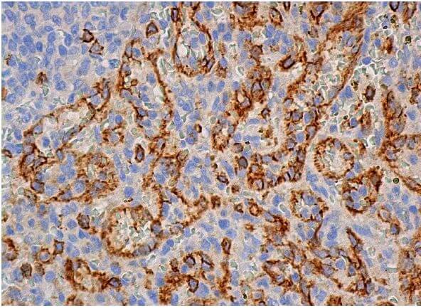 CD8-α Antibody (C8/144B) | SCBT - Santa Cruz Biotechnology CD8-α Antibody (C8/144B) | SCBT - Santa Cruz Biotechnology