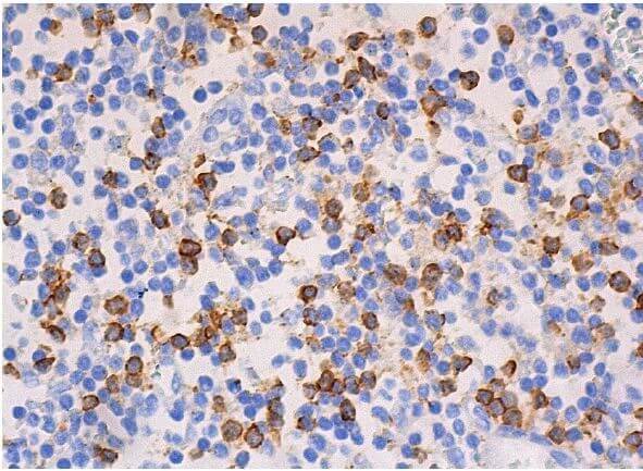 CD8-α Antibody (C8/144B) | SCBT - Santa Cruz Biotechnology CD8-α Antibody (C8/144B) | SCBT - Santa Cruz Biotechnology