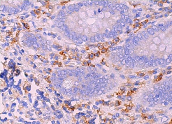 CD88 Antibody (B-6) | SCBT - Santa Cruz Biotechnology