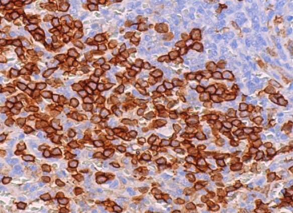 CD88 Antibody (B-6) | SCBT - Santa Cruz Biotechnology