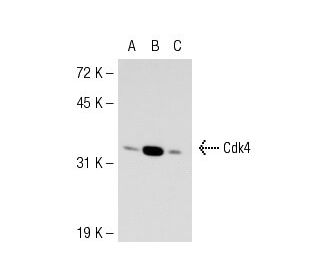 Anti-Cdk4 Antibody (DCS-35) | SCBT - Santa Cruz Biotechnology