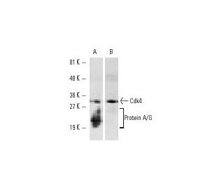 Anti-Cdk4 Antibody (DCS-35) | SCBT - Santa Cruz Biotechnology