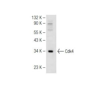 Anti-Cdk4 Antibody (DCS-35) | SCBT - Santa Cruz Biotechnology