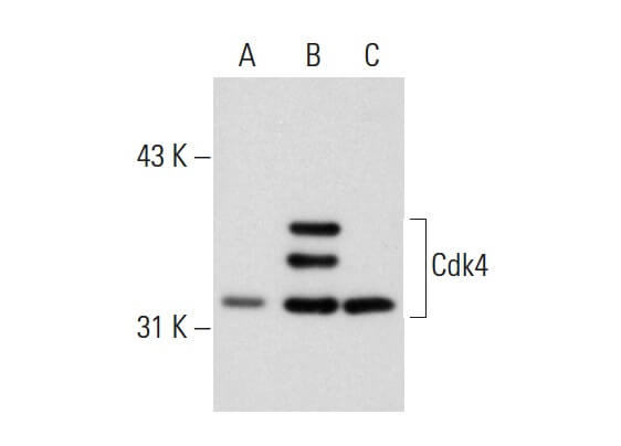 Anti-Cdk4 Antibody (DCS-35) | SCBT - Santa Cruz Biotechnology