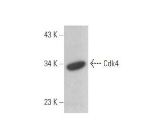 Anti-Cdk4 Antibody (DCS-35) | SCBT - Santa Cruz Biotechnology