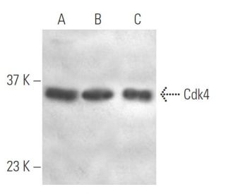 Anti-Cdk4 Antibody (DCS-35) | SCBT - Santa Cruz Biotechnology