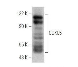 CDKL5 Antibody (D-12) - Western Blotting - Image 366902