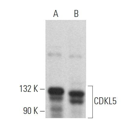 CDKL5 Antibody (D-12) | SCBT - Santa Cruz Biotechnology