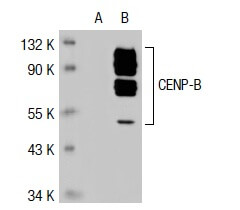 CENP-B Antibody (2D-7) | SCBT - Santa Cruz Biotechnology