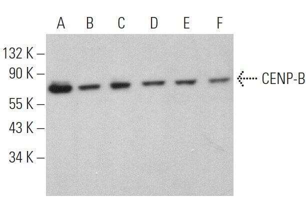 CENP-B Antibody (2D-7) | SCBT - Santa Cruz Biotechnology