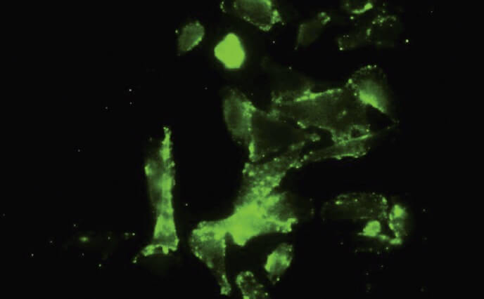 Anti-CENP-K Antibody (40.3) | SCBT - Santa Cruz Biotechnology