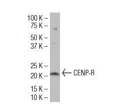 Anti-CENP-R Antibody (G-78) | SCBT - Santa Cruz Biotechnology