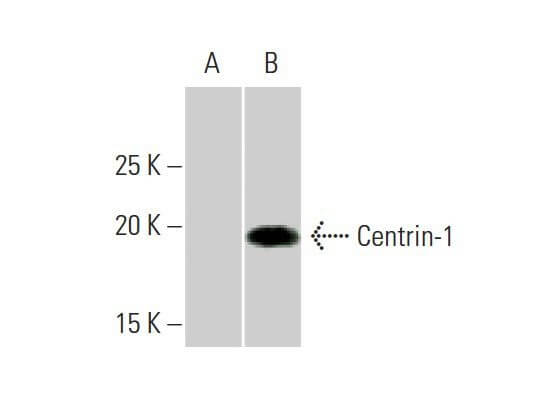Anti-Centrin-1 Antibody (2A6) | SCBT - Santa Cruz Biotechnology
