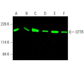 CFTR Antibody (A-3) - Western Blotting - Image 378805