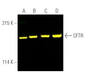 CFTR Antibody (A-3) - Western Blotting - Image 391213