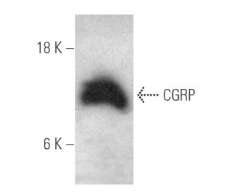 CGRP Antibody (4901) - Western Blotting - Image 390987