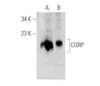 CGRP Antibody (4901) - Western Blotting - Image 395162
