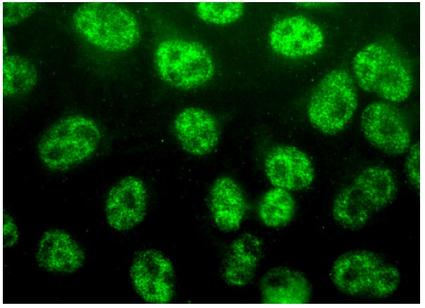 Anti-CGRP-RCP Antibody (D-1) | SCBT - Santa Cruz Biotechnology
