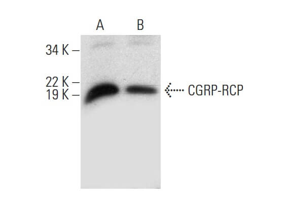 Anti-CGRP-RCP Antibody (D-1) | SCBT - Santa Cruz Biotechnology