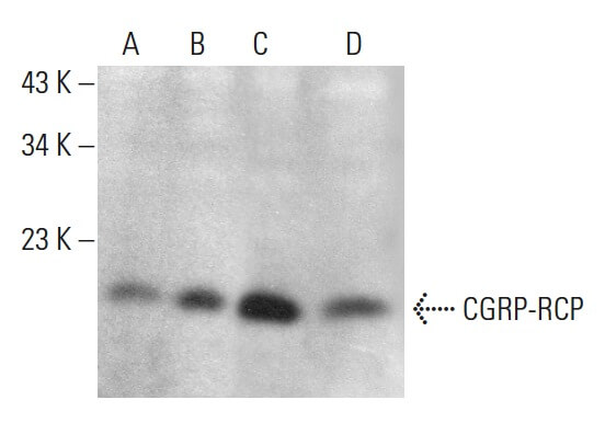 Anti-CGRP-RCP Antibody (D-1) | SCBT - Santa Cruz Biotechnology