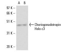 Choriogonadotropin Holo c3抗体 (INN-hCG-45) | SCBT - Santa Cruz Biotechnology