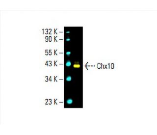 Chx10 Antibody (E-12) | SCBT - Santa Cruz Biotechnology