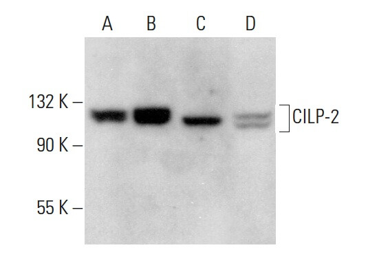 Anti-CILP-2 Antibody (B-1) | SCBT - Santa Cruz Biotechnology