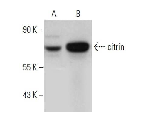 citrin Antibody (D-7) | SCBT - Santa Cruz Biotechnology