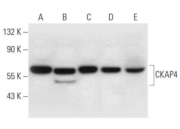 CKAP4 Antibody (A-3) | SCBT - Santa Cruz Biotechnology