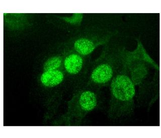 Claspin Antibody (B-6) | SCBT - Santa Cruz Biotechnology