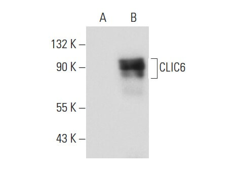 CLIC6 Antibody (E-11) | SCBT - Santa Cruz Biotechnology