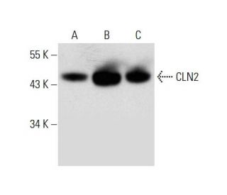CLN2 Antibody (D-11) | SCBT - Santa Cruz Biotechnology