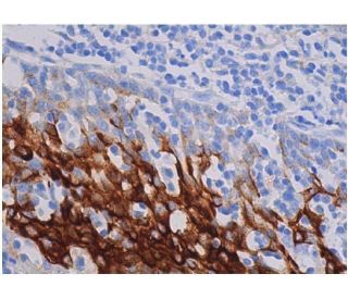 Clusterin-α Antibody (A-11) | SCBT - Santa Cruz Biotechnology