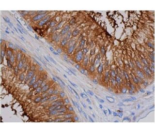 Clusterin-α Antibody (A-11) | SCBT - Santa Cruz Biotechnology