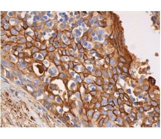 Clusterin Antibody (A-9) | SCBT - Santa Cruz Biotechnology