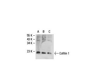 Cofilin 1 Antibody (5) - Western Blotting - Image 18092