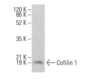 Cofilin 1 Antibody (5) - Western Blotting - Image 376231