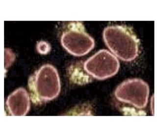 coilin Antibody (56) | SCBT - Santa Cruz Biotechnology