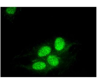 Anti-coilin Antibody (B-7) | SCBT - Santa Cruz Biotechnology