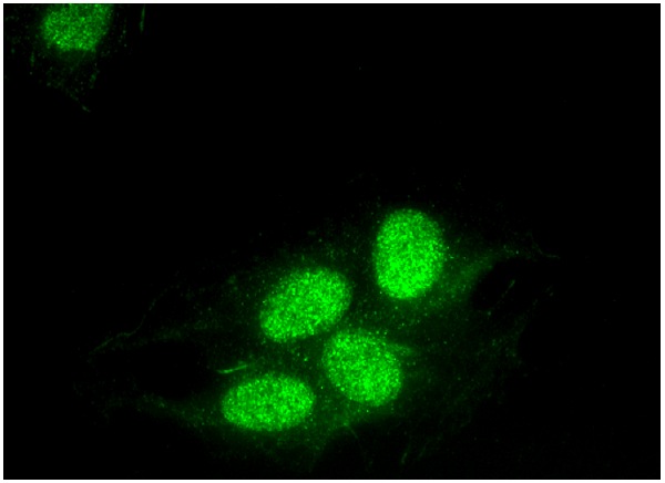 Anti-coilin Antibody (B-7) | SCBT - Santa Cruz Biotechnology