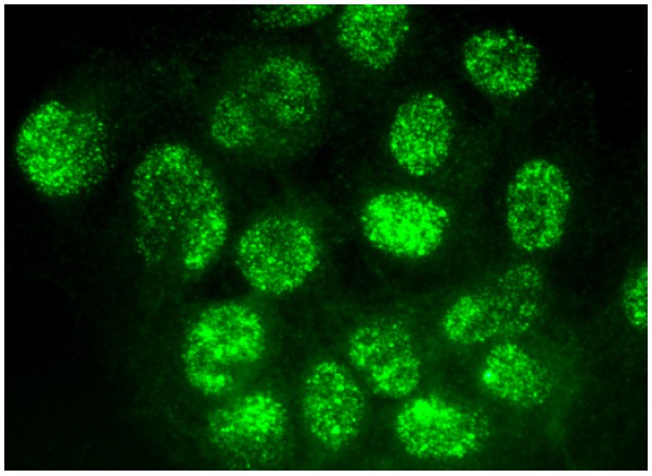 Anti-coilin Antibody (F-7) | SCBT - Santa Cruz Biotechnology